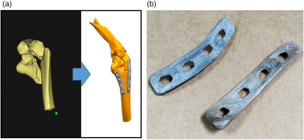 In vitro degradation behavior of 3D-printed bone fixation plates